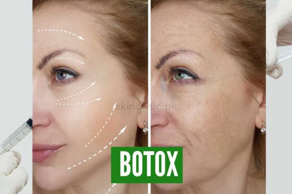 SkinClinic.pk | All about skin care and skin clinic in Pakistan