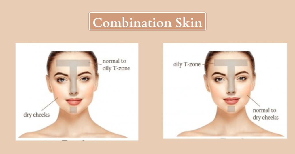Embracing the Duality of Combination Skin | SkinClinic.pk