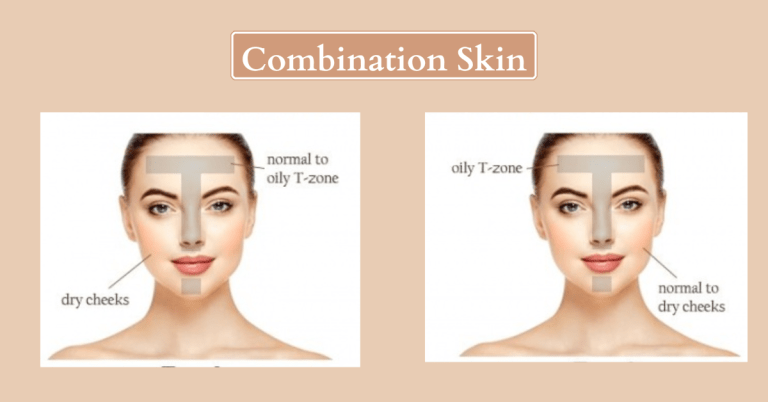 Embracing the Duality of Combination Skin | SkinClinic.pk