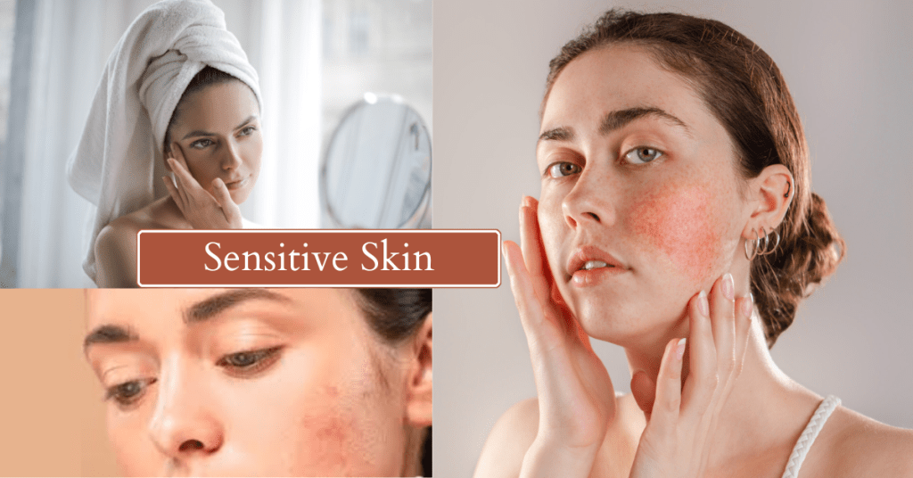 Sensitive Skin Sanctuary: Embracing Delicacy with Care and Confidence ...
