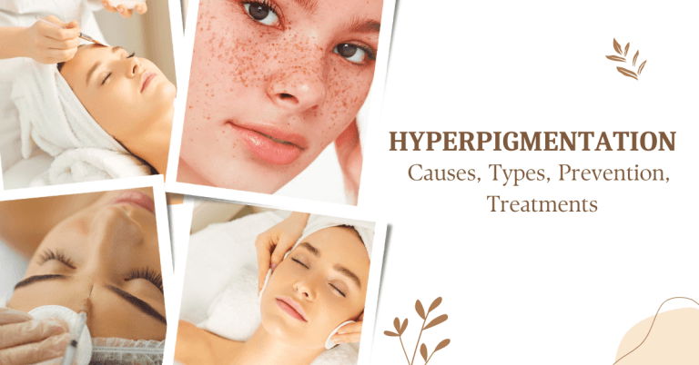A Comprehensive Guide to Hyperpigmentation Causes, Types, Prevention ...